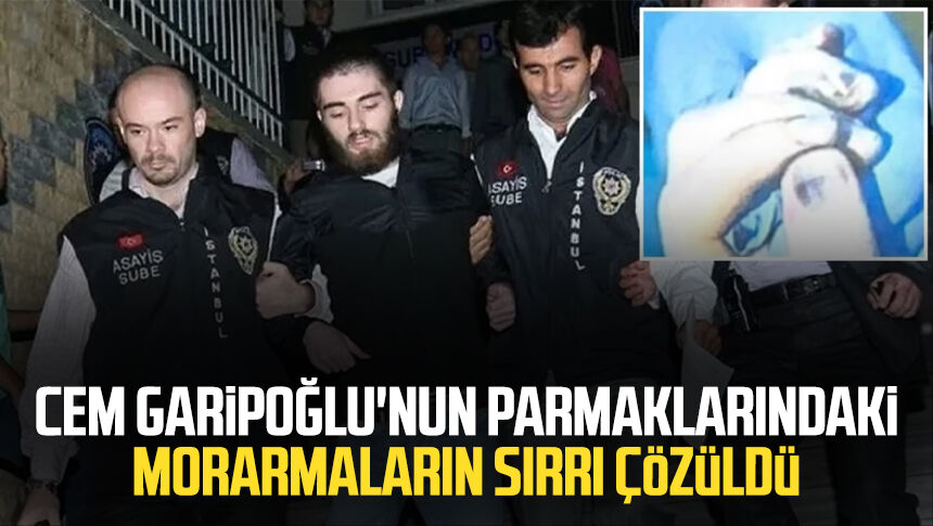 Dikkat çekmişti: Cem Garipoğlu'nun parmaklarındaki morarmaların sırrı ...