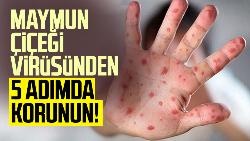 Maymun çiçeği virüsünden 5 adımda korunun! - Samsun Haber, Samsun Son ...